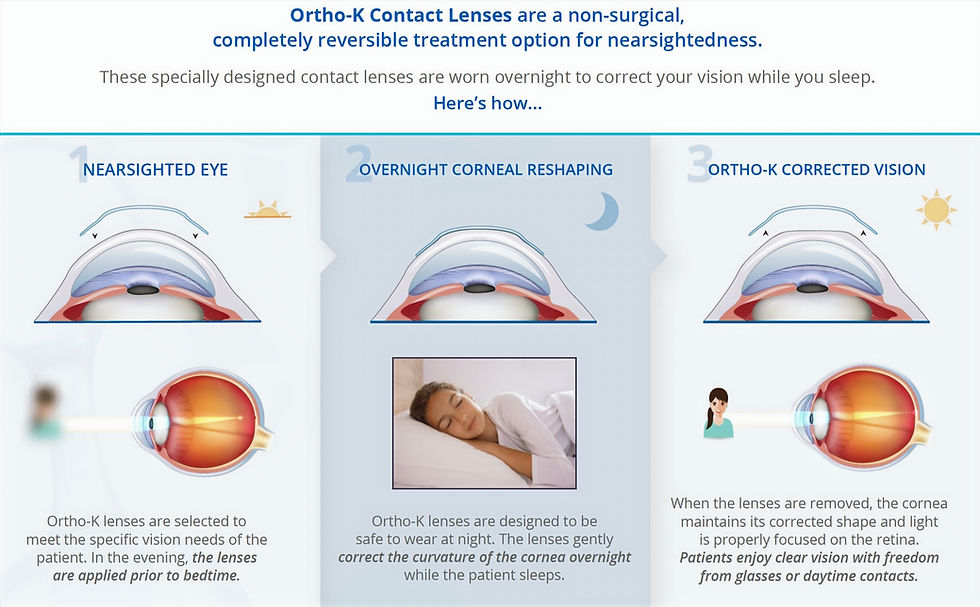 Ortho K Lenses Visionopolis